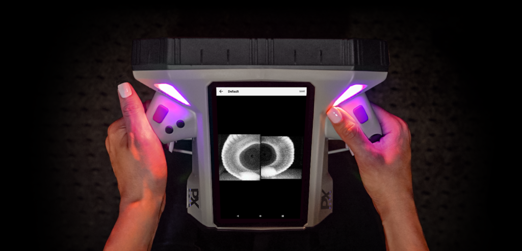 Handheld X-ray imager – PX Ultra